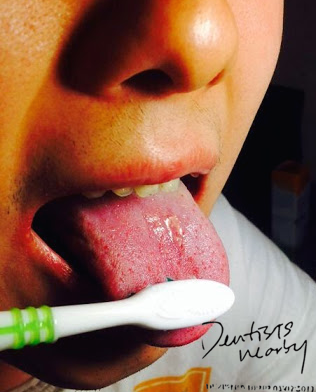 What is Halitosis (Bad Breath)? | Dental Clinics, Dentists, Klinik Gigi ...