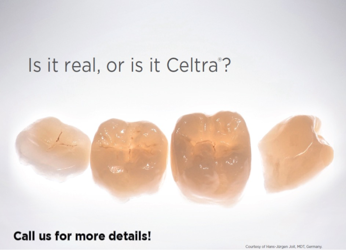 Is it Real, or Is it Celtra? DentsplySirona Malaysia | Dental Clinics ...