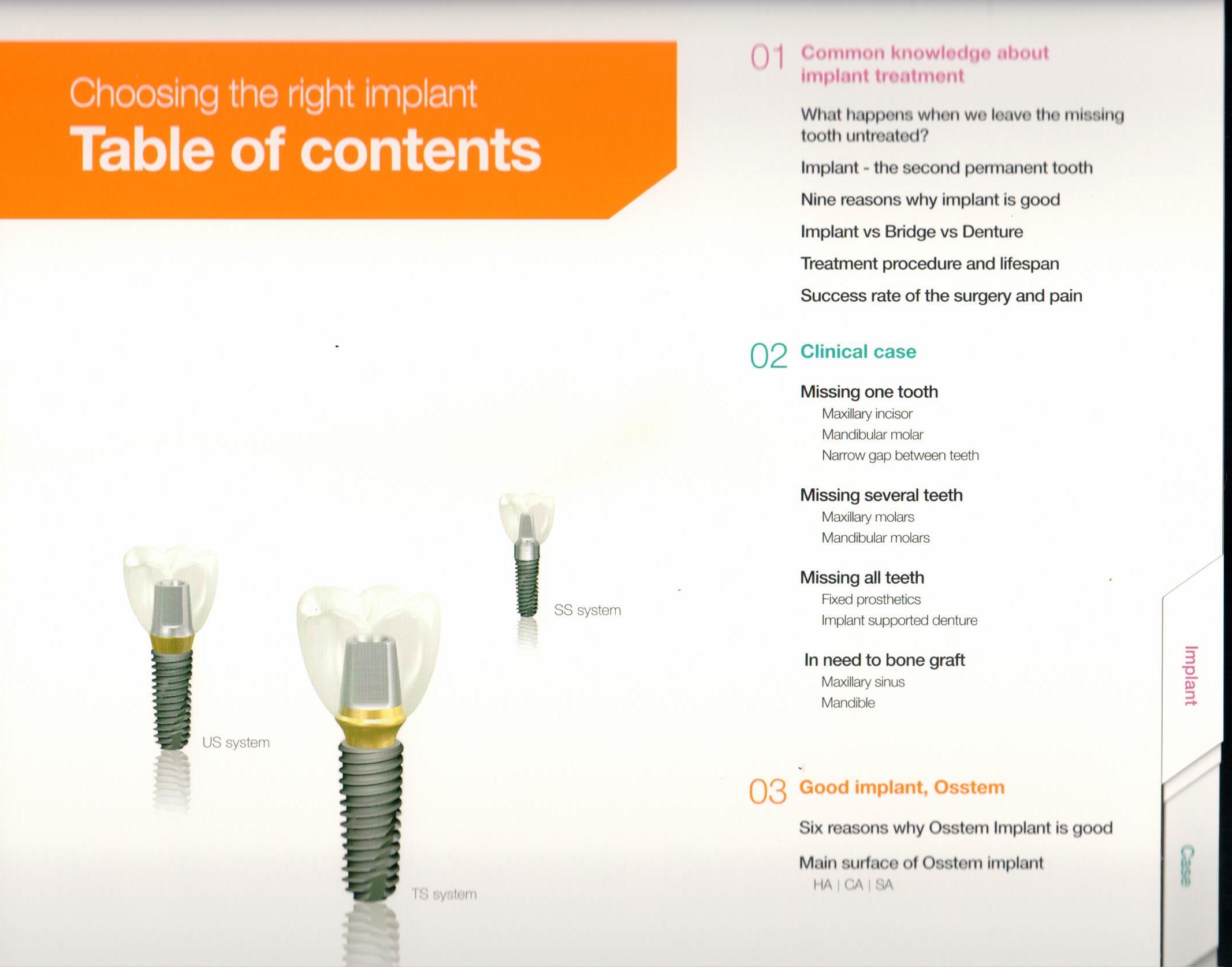 Implant, The Second Permanent Teeth (Osstem®) | Dental Clinics ...