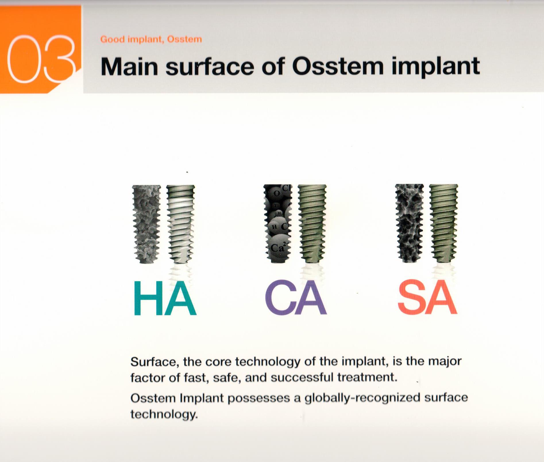Implant, The Second Permanent Teeth (Osstem®) | Dental Clinics ...