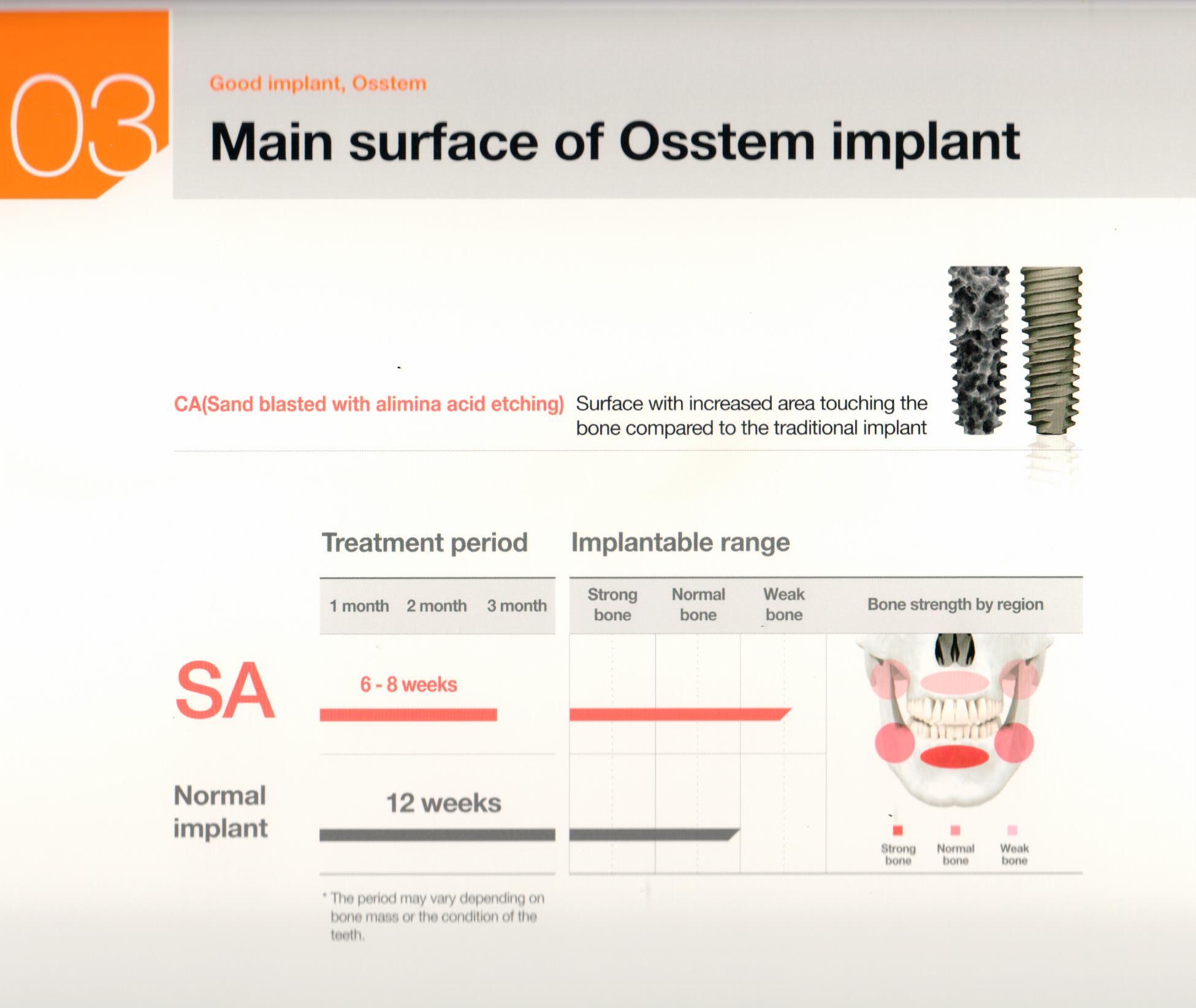 Implant, The Second Permanent Teeth (Osstem®) | Dental Clinics ...